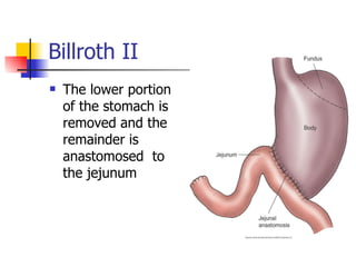 Peptic ulcer disease | PPT