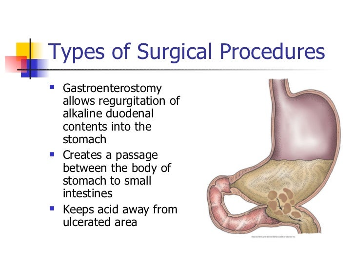 Peptic ulcer disease