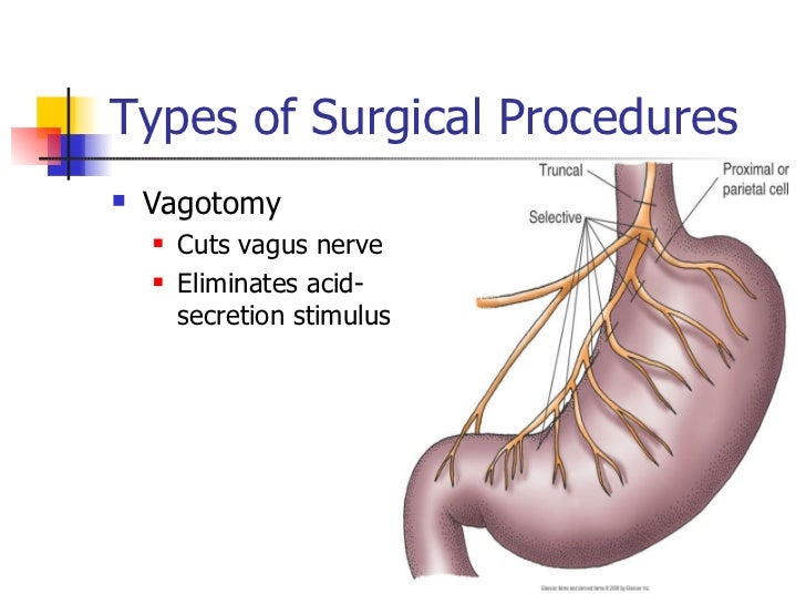 Peptic ulcer disease