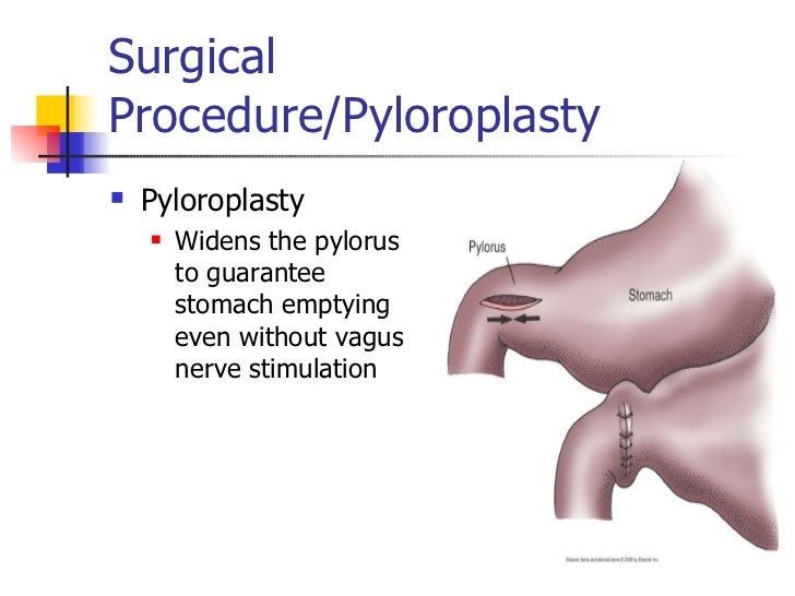 Peptic ulcer disease