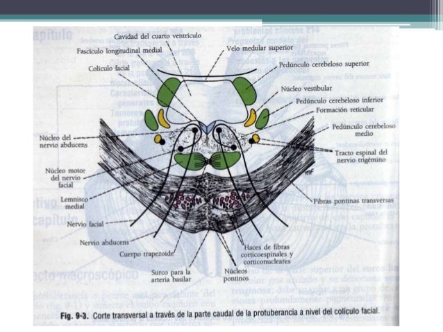 Puente o protuberancia