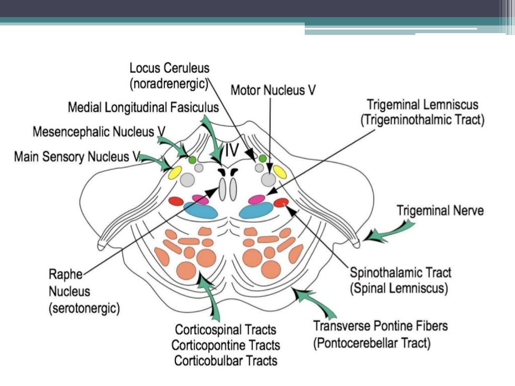 Puente o protuberancia