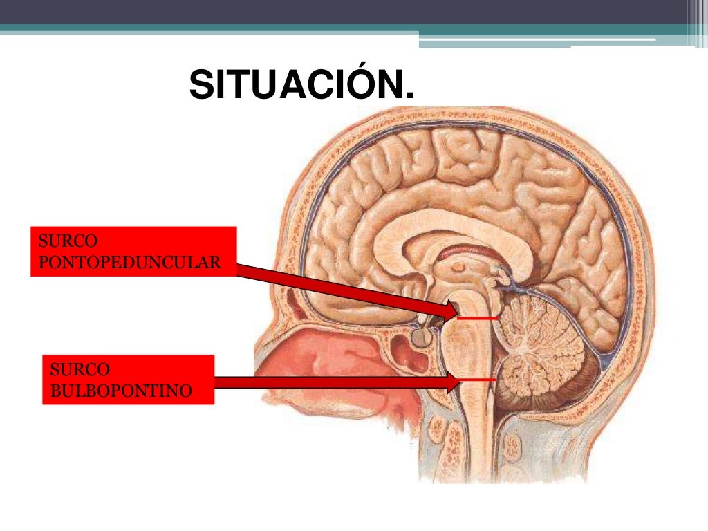 Puente o protuberancia