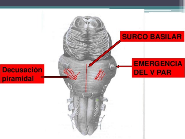 Puente o protuberancia