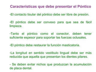 Puente provicional | PPT
