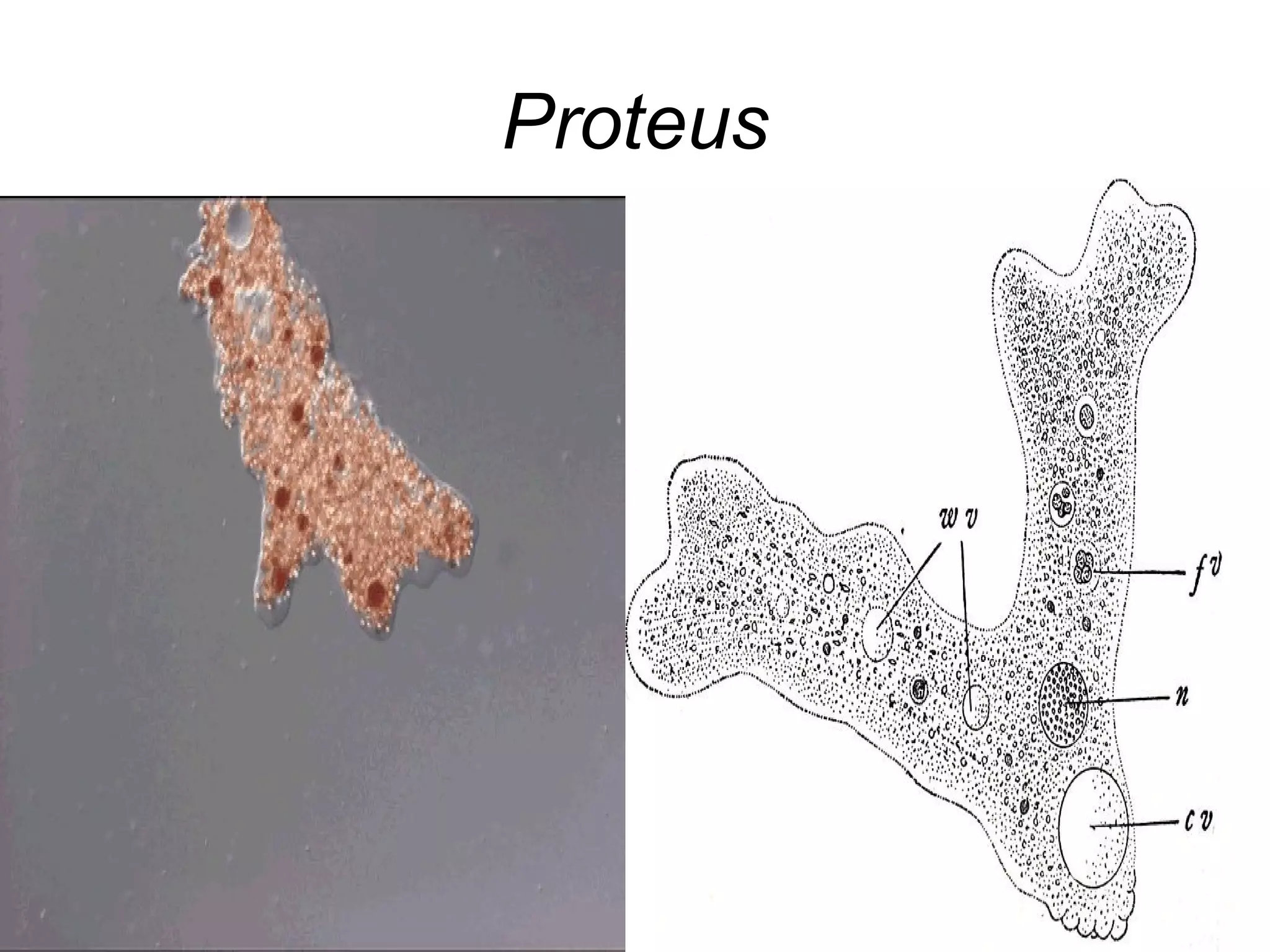 Puerperal sepsis | PPT