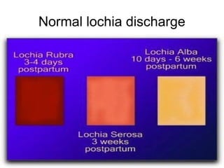 Puerperal sepsis | PPT