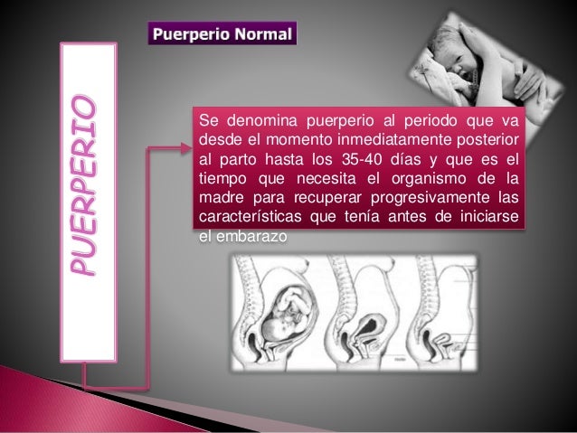 Puerperio normal