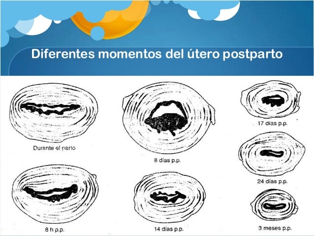 Puerperio y lactancia