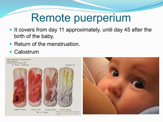 Puerperium | PPT
