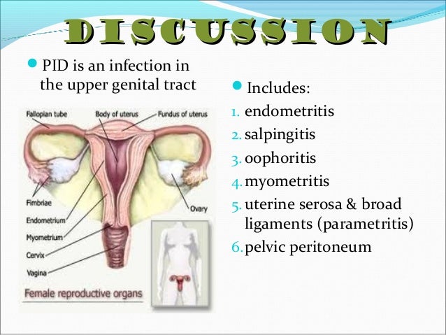 Pelvic Inflammatory Disease