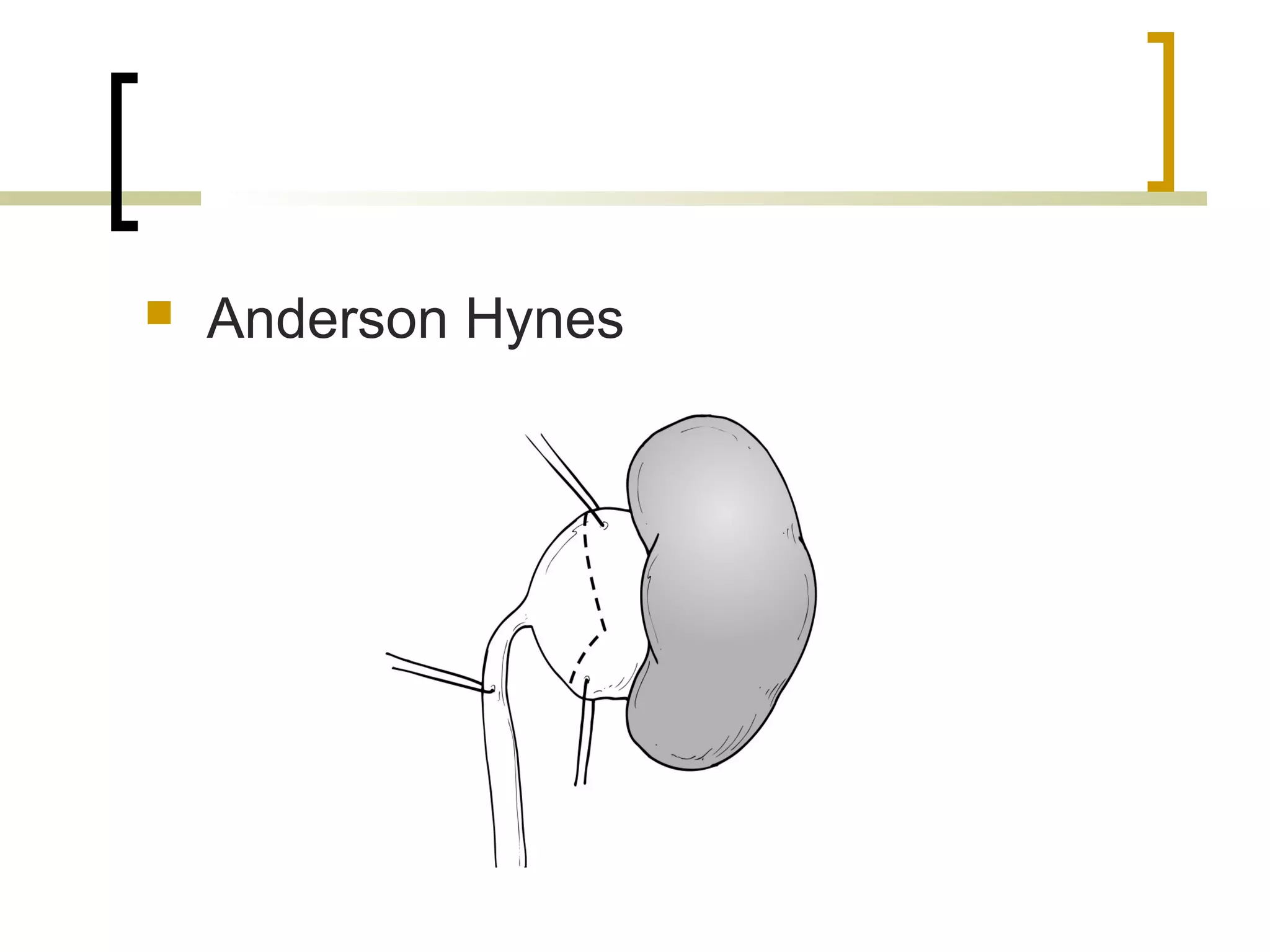 Puj obstruction | PPT