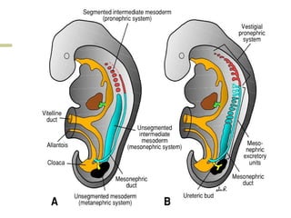 Puj obstruction | PPT