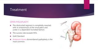 PUJ obstruction.pptx | Pregnancy | Reproductive Health