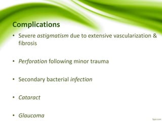 Peripheral Ulcerative Keratitis.Dr Ferdous | PPTX