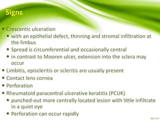 Peripheral Ulcerative Keratitis.Dr Ferdous | PPTX