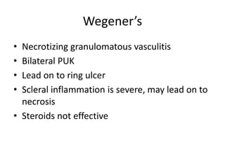 PERIPHERAL ULCERATIVE KERATITIS | PPTX