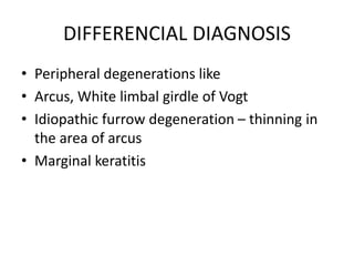 PERIPHERAL ULCERATIVE KERATITIS | PPTX