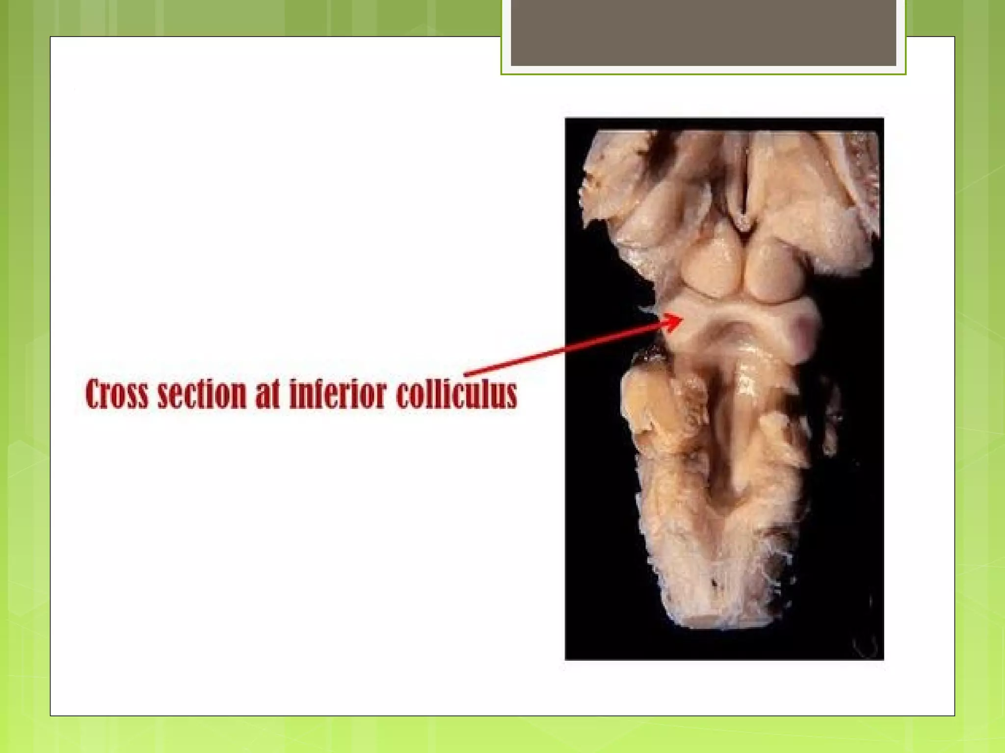 MIDBRAIN basic anatomy and applied aspects. | PPT