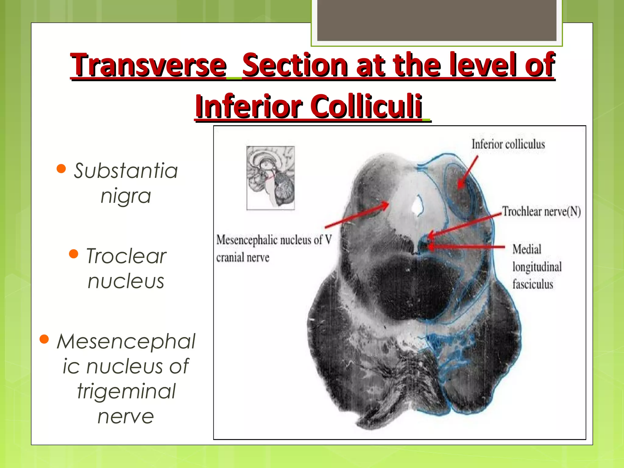 MIDBRAIN basic anatomy and applied aspects. | PPT