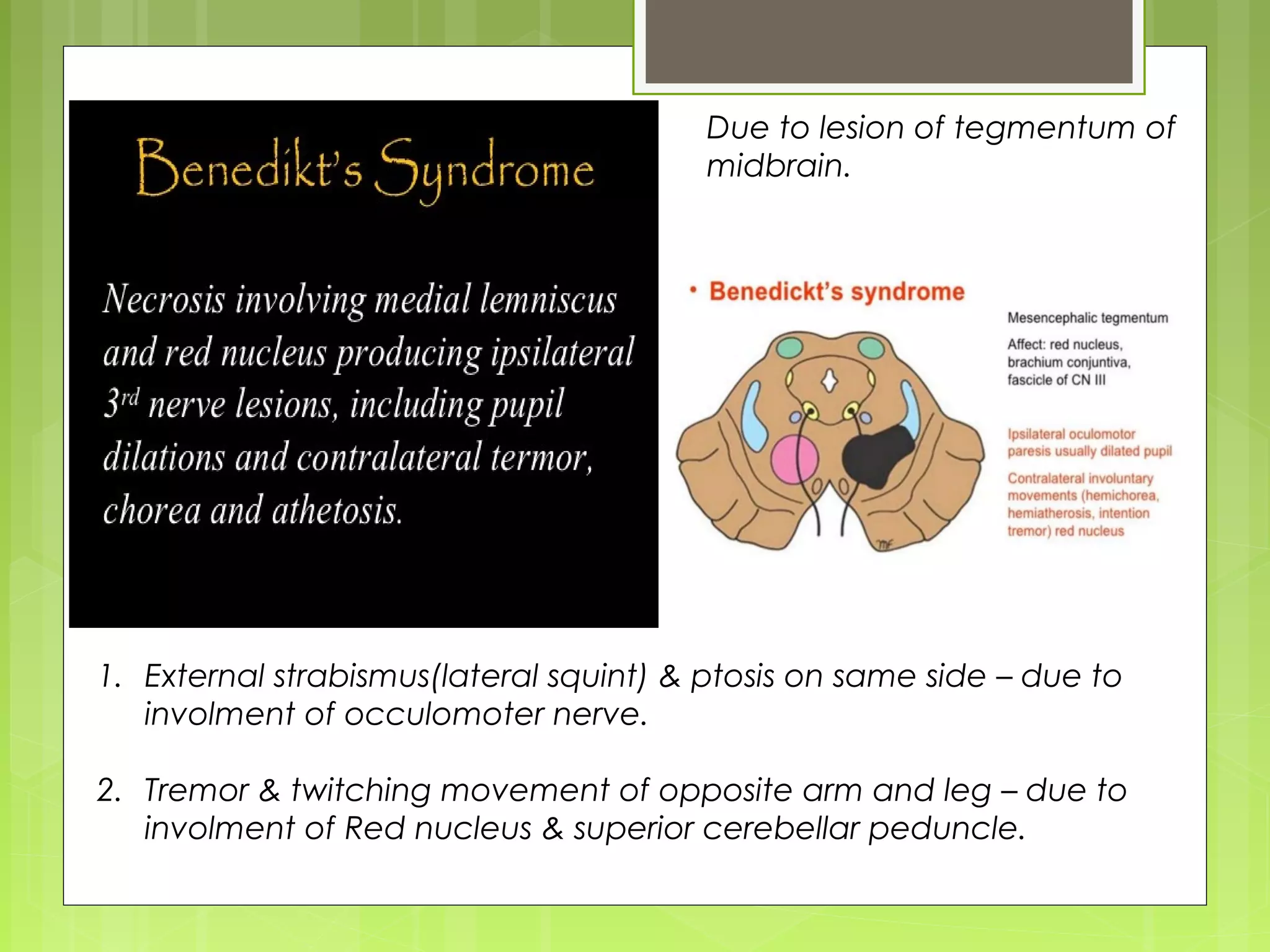 MIDBRAIN basic anatomy and applied aspects. | PPT