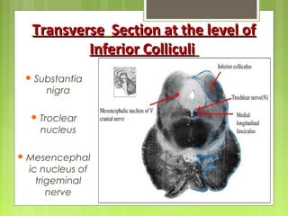 MIDBRAIN basic anatomy and applied aspects. | PPT