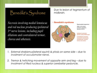 MIDBRAIN basic anatomy and applied aspects. | PPT