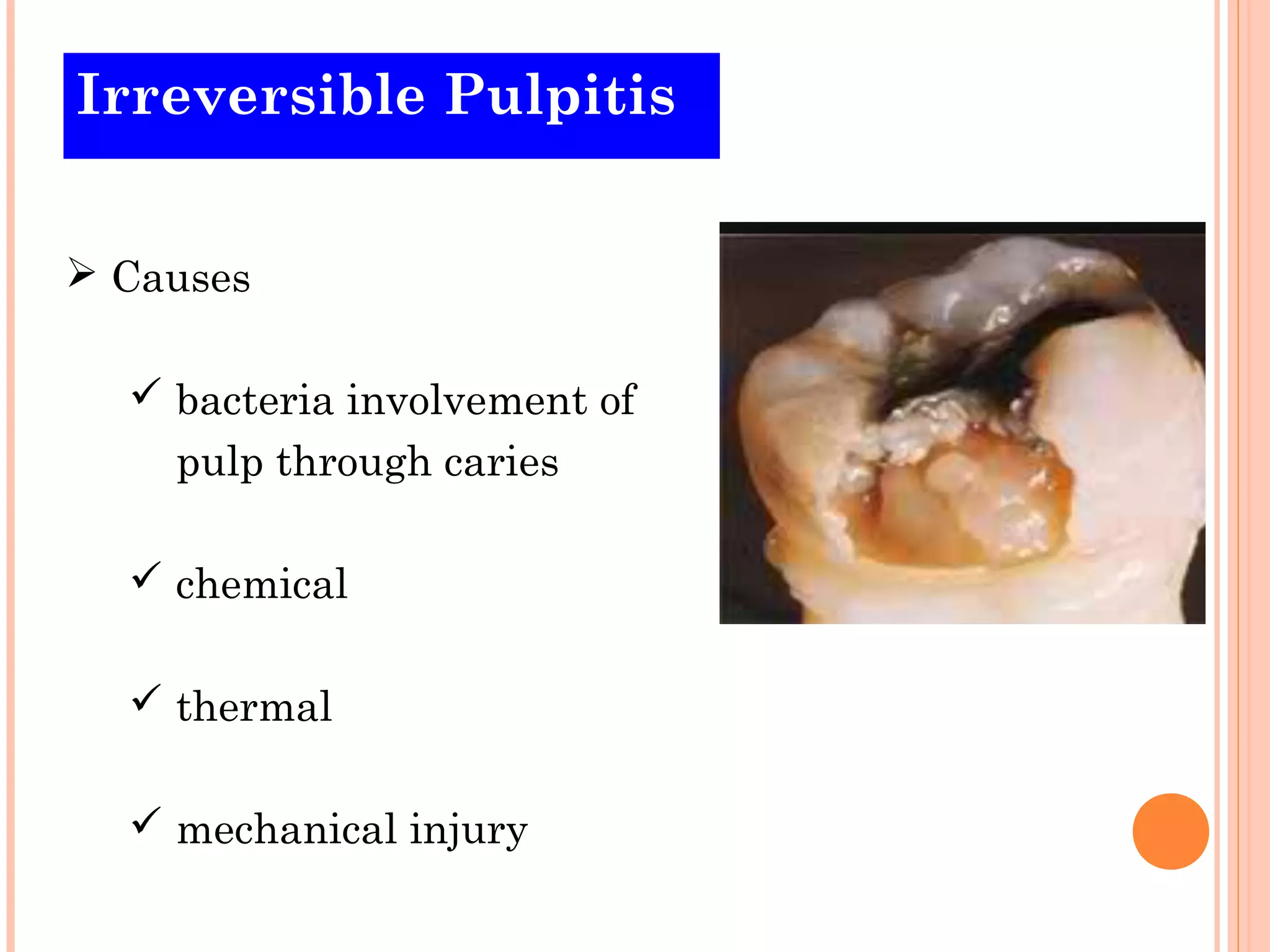 Pulipitis | PPT