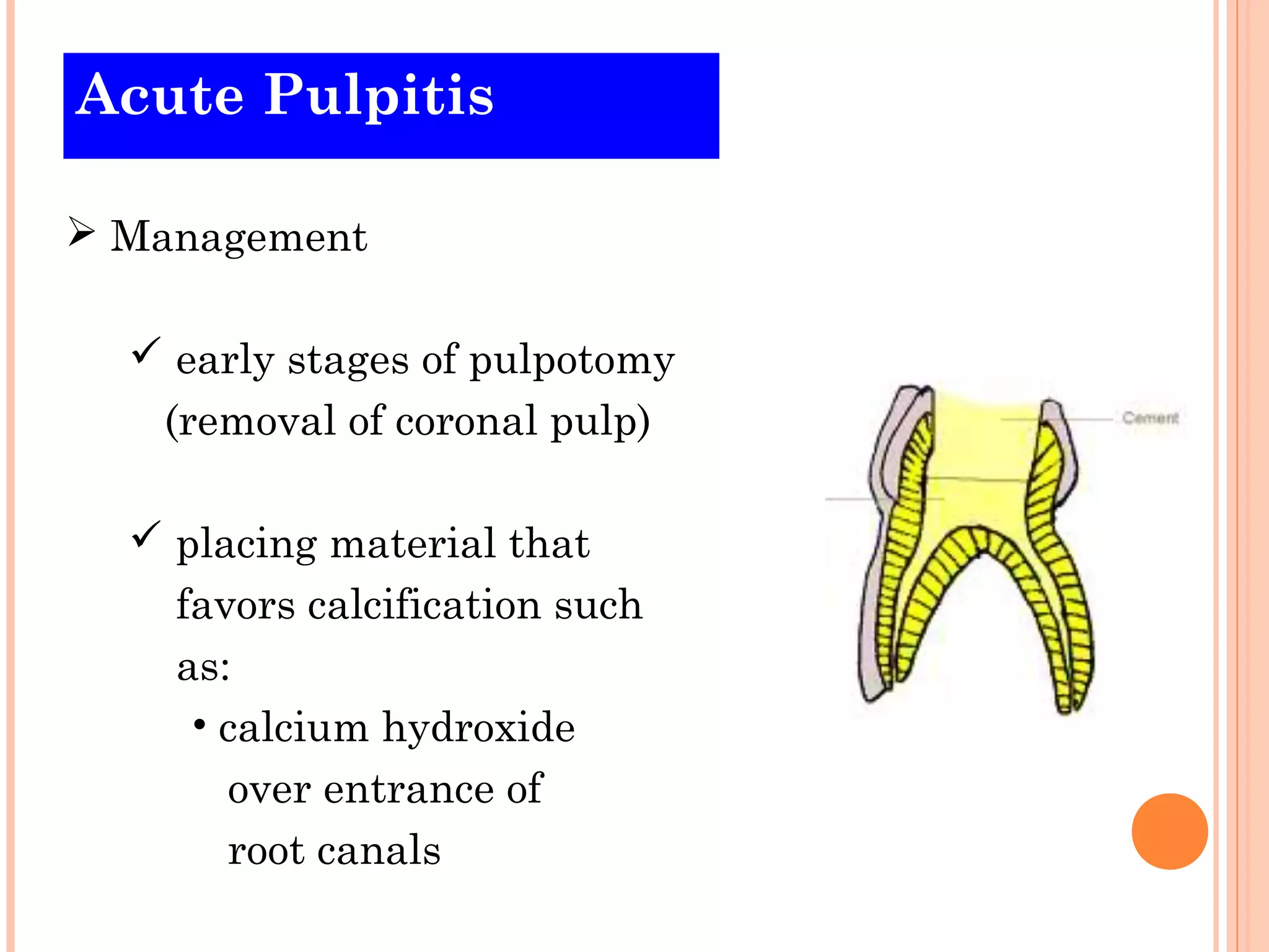 Pulipitis | PPT