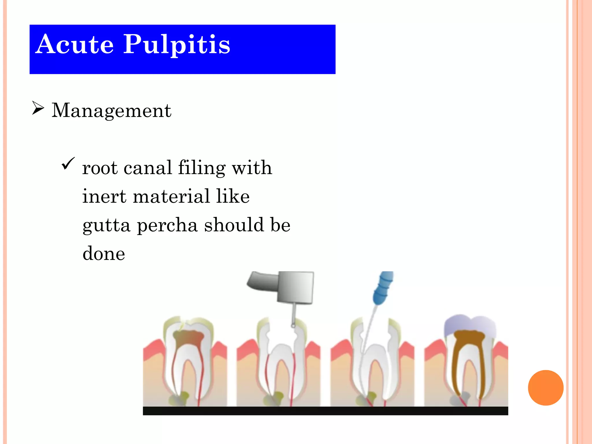Pulipitis | PPT