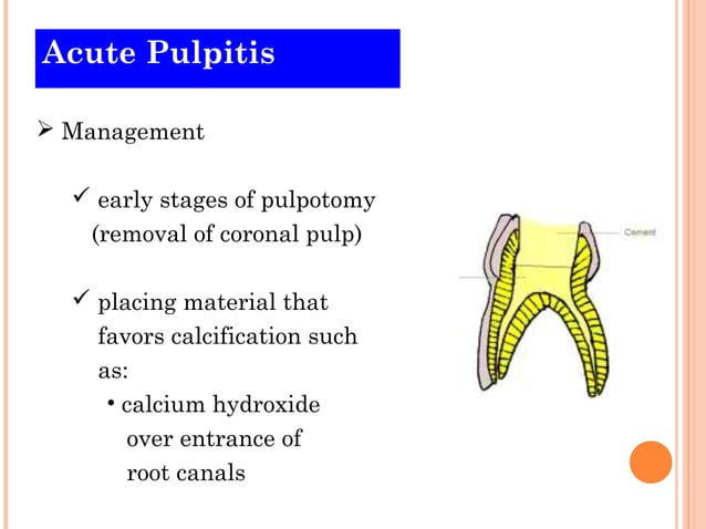 Pulipitis | PPT
