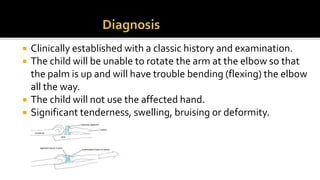 Pulled elbow | PPTX