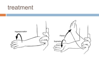 Pull elbow | PPTX | Death, Injury, or Military Conflict | Sensitive Topics