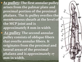 PULLEYS OF HAND. PPT..pptx