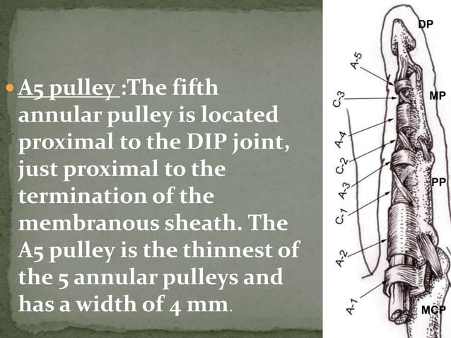 PULLEYS OF HAND. PPT..pptx
