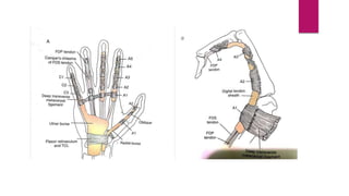 Pulley system in hand | PPTX