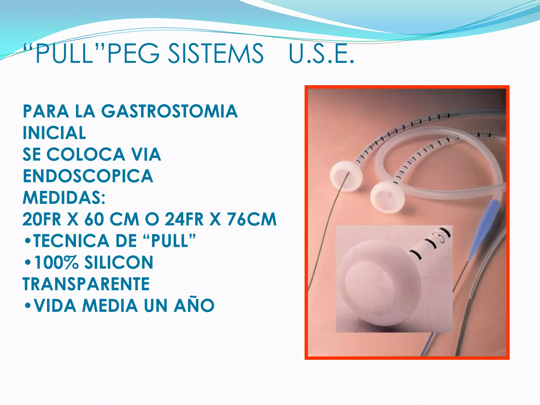 Pull peg sistem | PDF