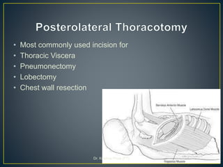 PulmonarySurgeries for Physiotherapists .pptx