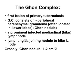 Pulmmonary tuberculosis | PPT