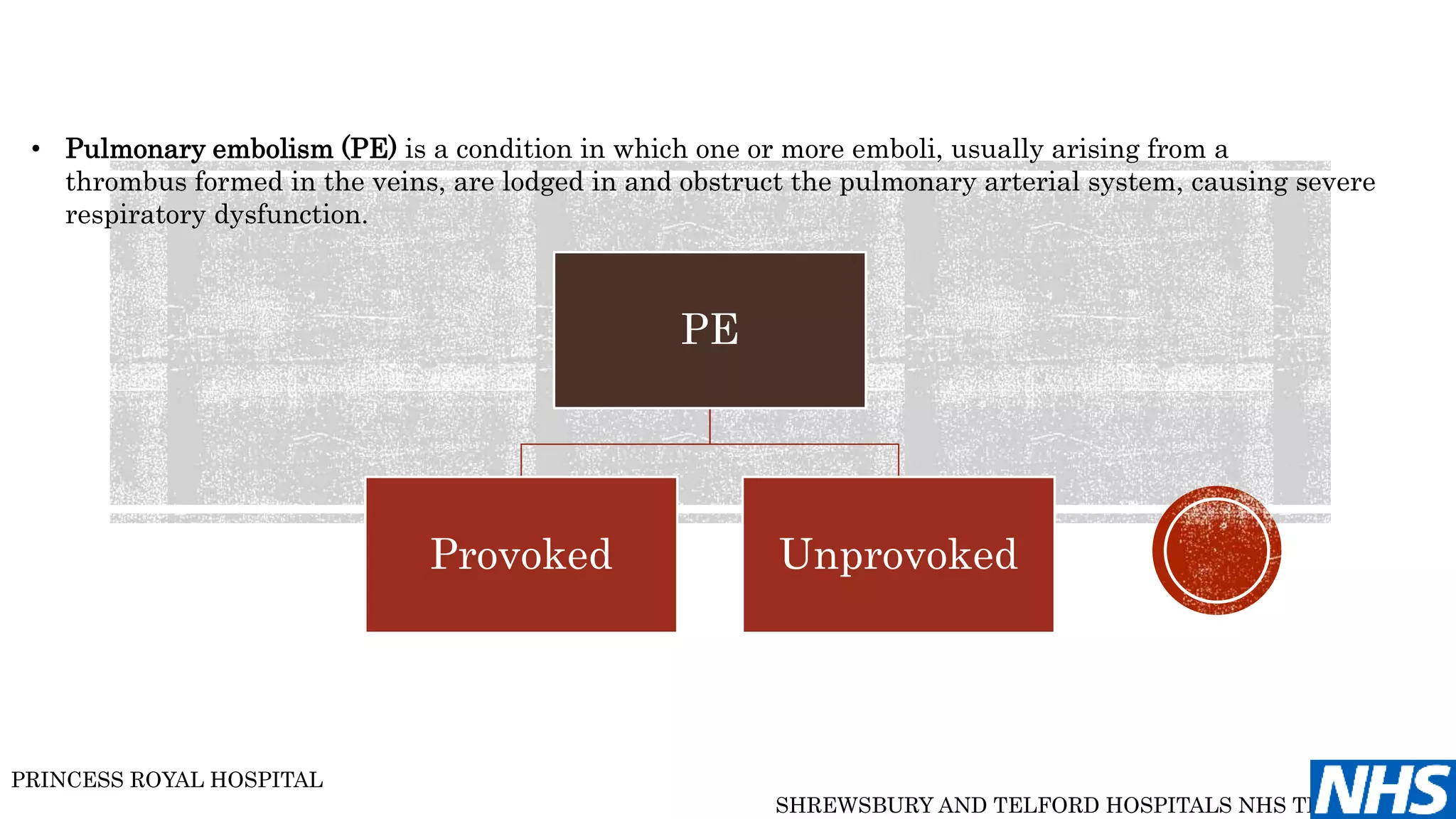 Pulmoary embolism | PPTX