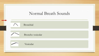 Approach to Lung Sounds.ppt