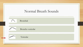 Approach to Lung Sounds.ppt