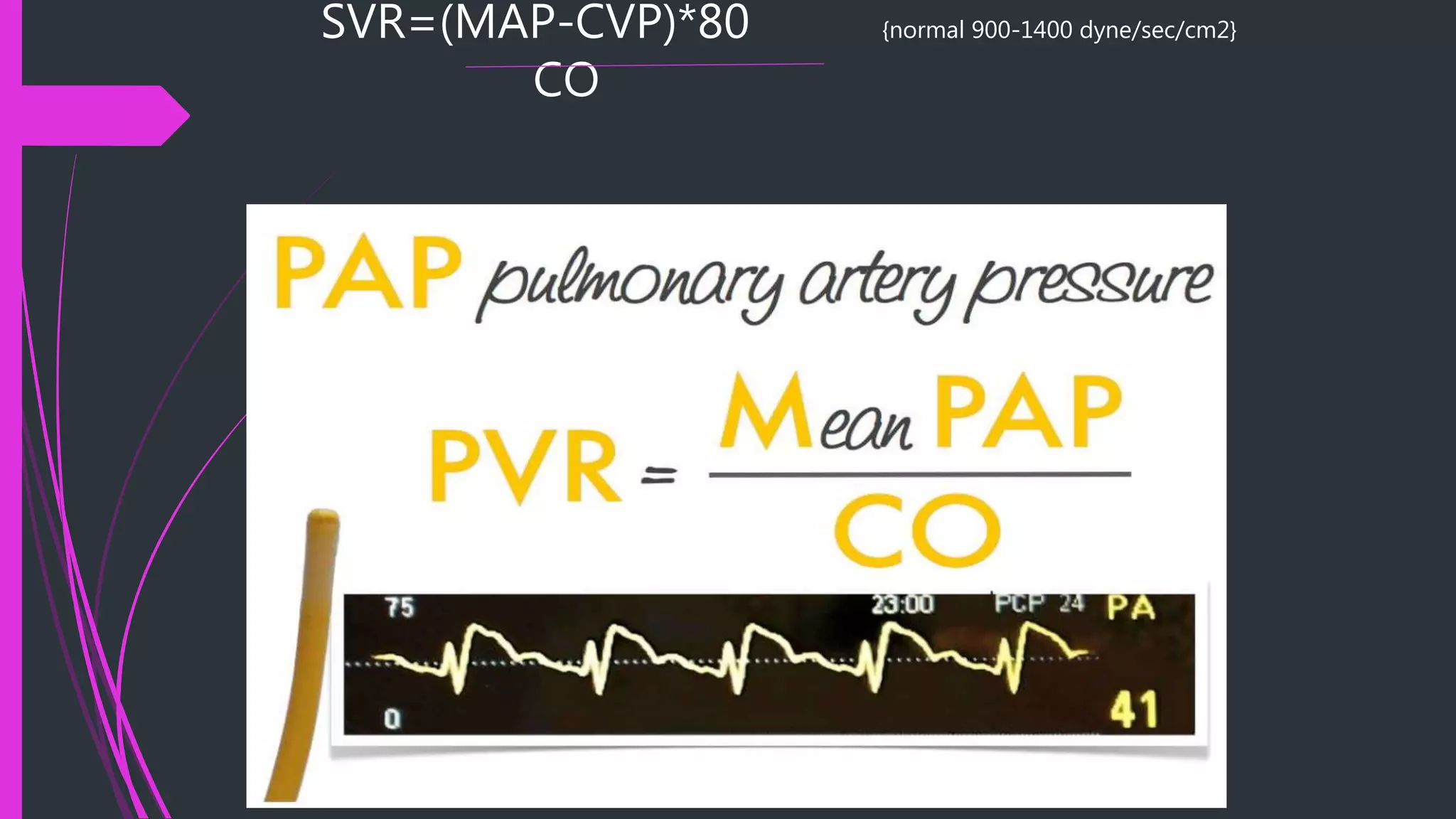 Pulmonary artery catheter | PPTX