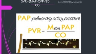 Pulmonary artery catheter | PPTX