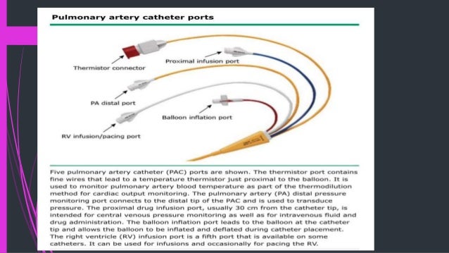Pulmonary artery catheter