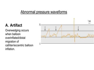 Pulmonary artery-catheter2 | PPTX