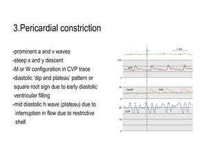 Pulmonary artery-catheter2 | PPTX