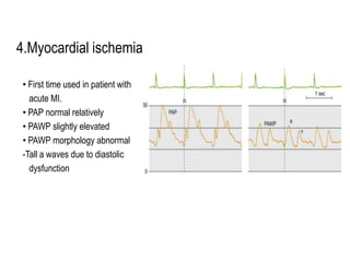 Pulmonary artery-catheter2 | PPTX