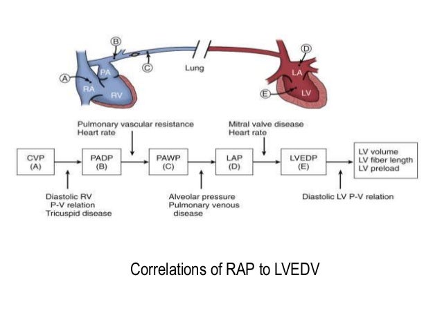 Pulmonary artery-catheter2