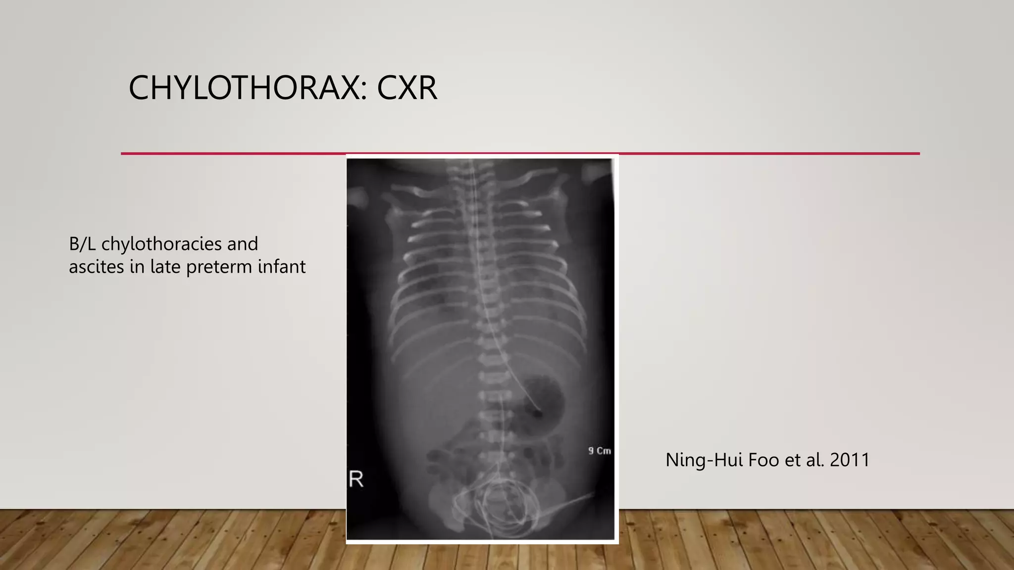 Pulmonary-Disease-Part-1.pptx